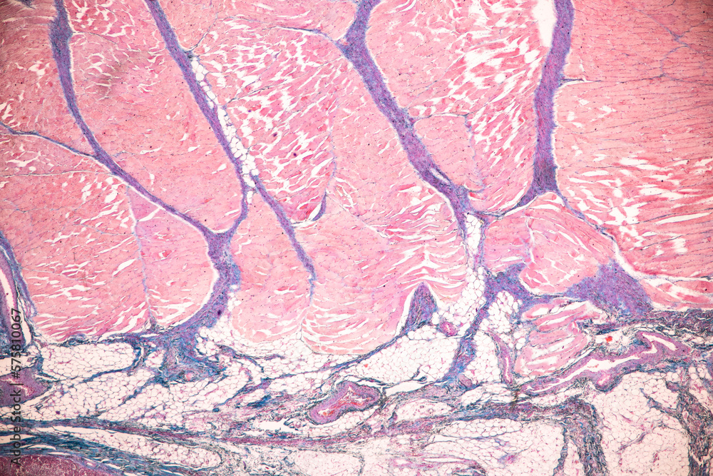 Adipose tissue human, Soft palate human, Bone human and Striated ...