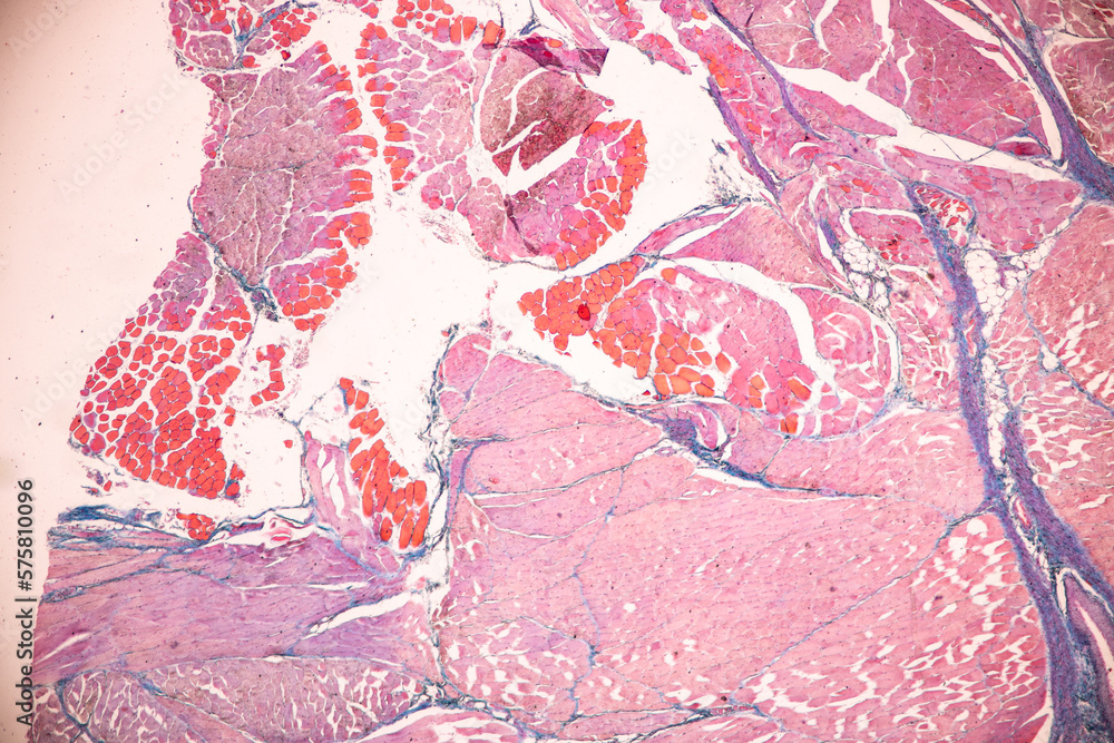 Adipose tissue human, Soft palate human, Bone human and Striated ...
