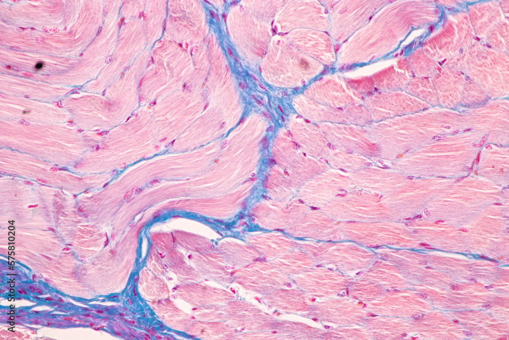 Adipose tissue human, Soft palate human, Bone human and Striated ...