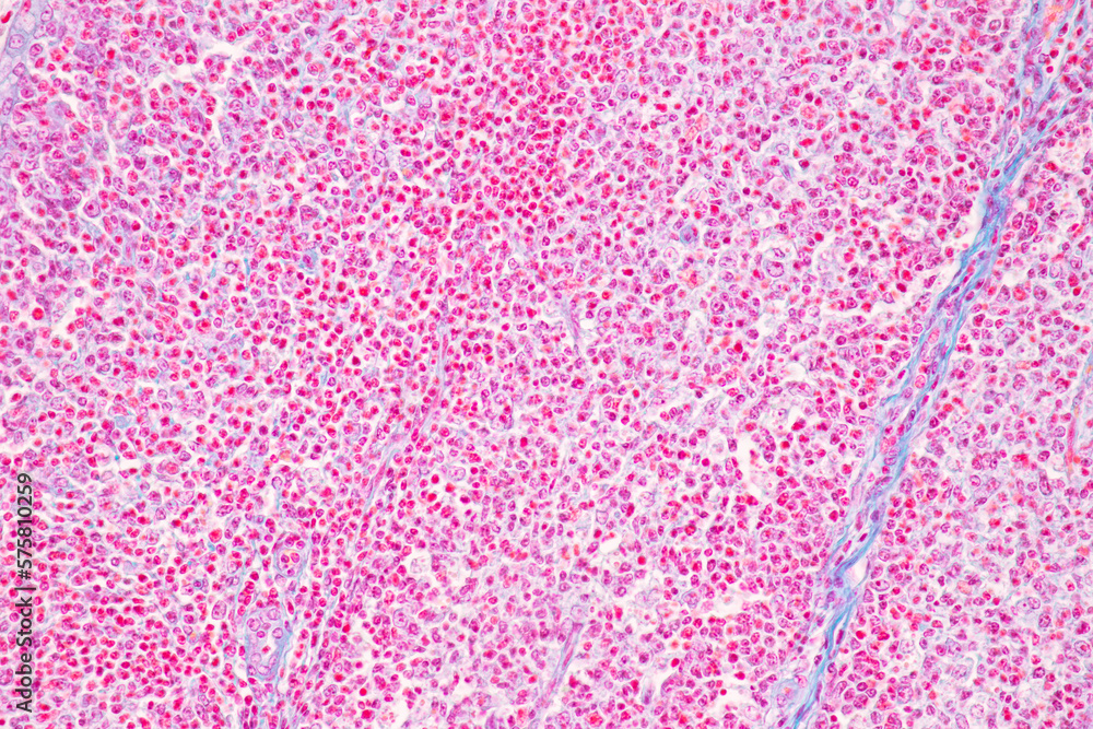 Adipose Tissue Human Soft Palate Human Bone Human And Striated Skeletal Muscle Human Under