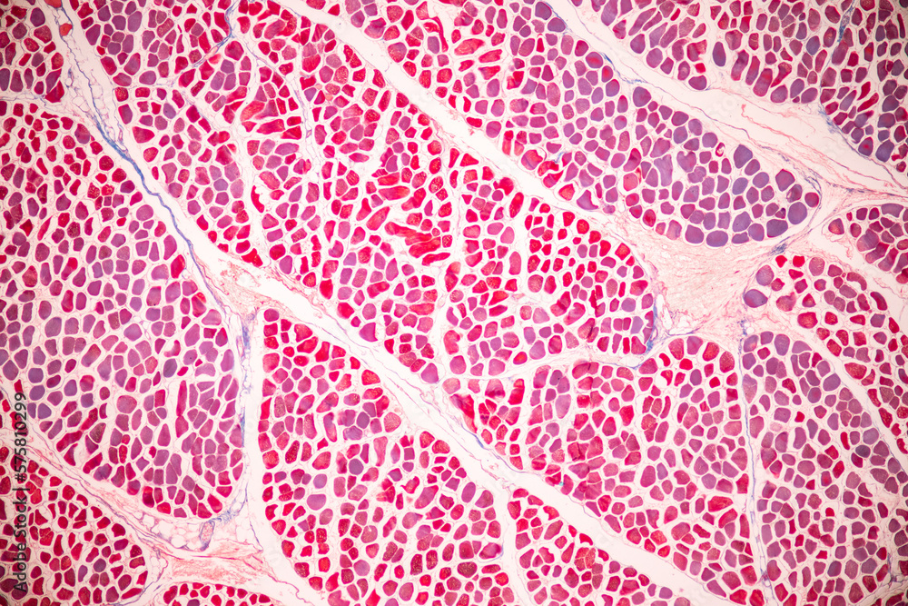 Adipose tissue human, Soft palate human, Bone human and Striated ...