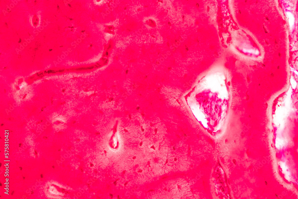 Adipose tissue human, Soft palate human, Bone human and Striated ...
