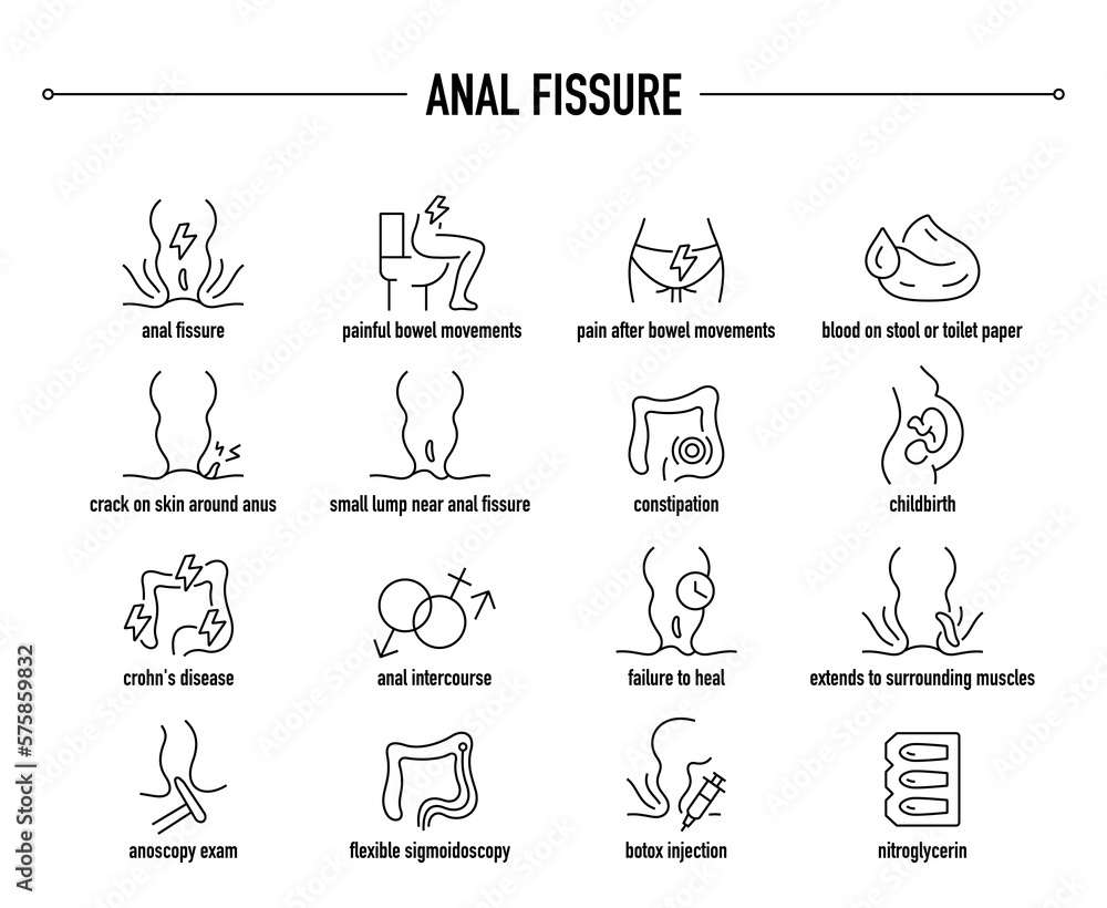 Anal Fissure symptoms, diagnostic and treatment vector icon set. Line editable medical icons ...