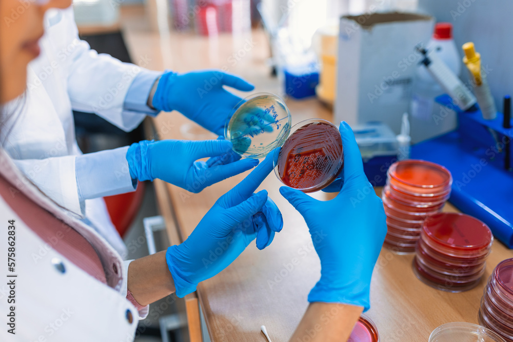 Scientist's hand hold a Petri dish with bacteria. Focused science ...