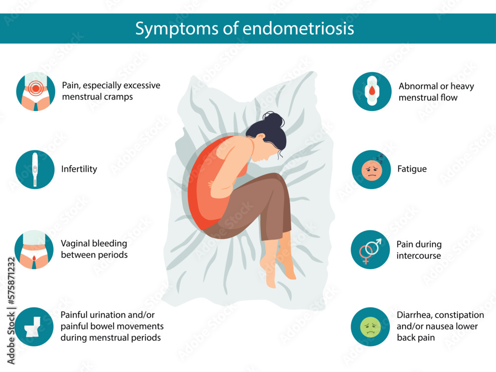 Poster Endometriosis Symptoms infographic – Wall Art | UkPosters