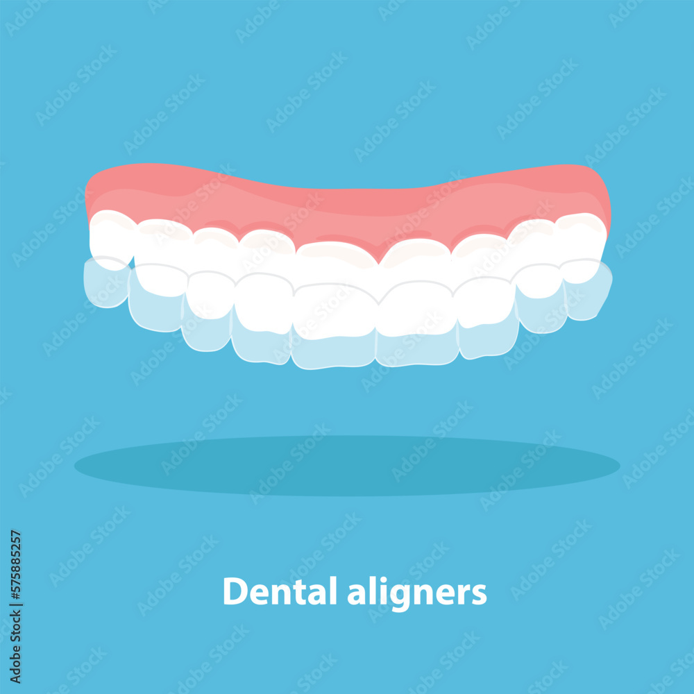 Alignment of teeth by aligners. Orthodontic dentistry concept Stock ...