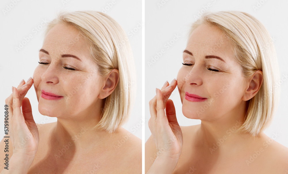 Closeup before after Beauty middle age woman face portrait. Before ...