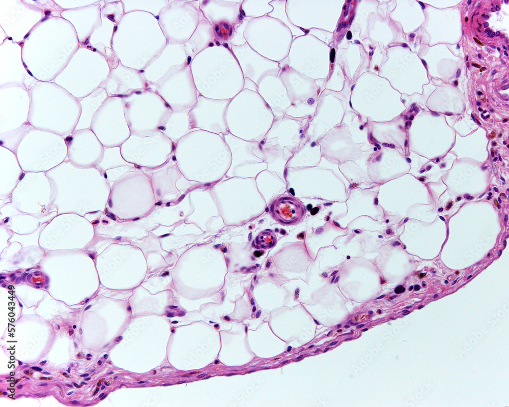 Adipose tissue Stock-Foto | Adobe Stock
