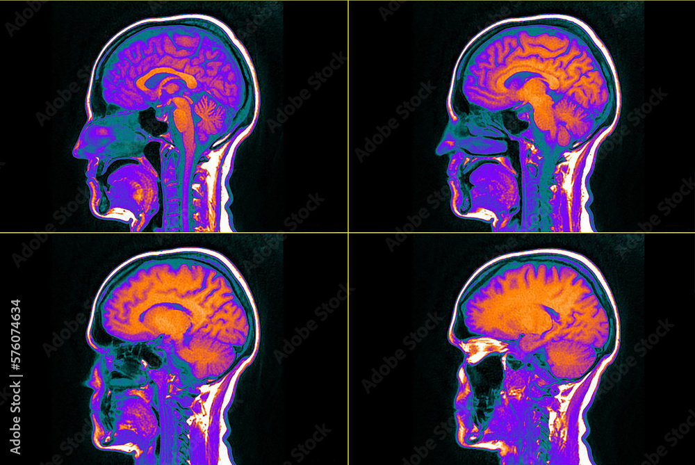 MRI of the brain. Medical image for the study of internal organs and ...