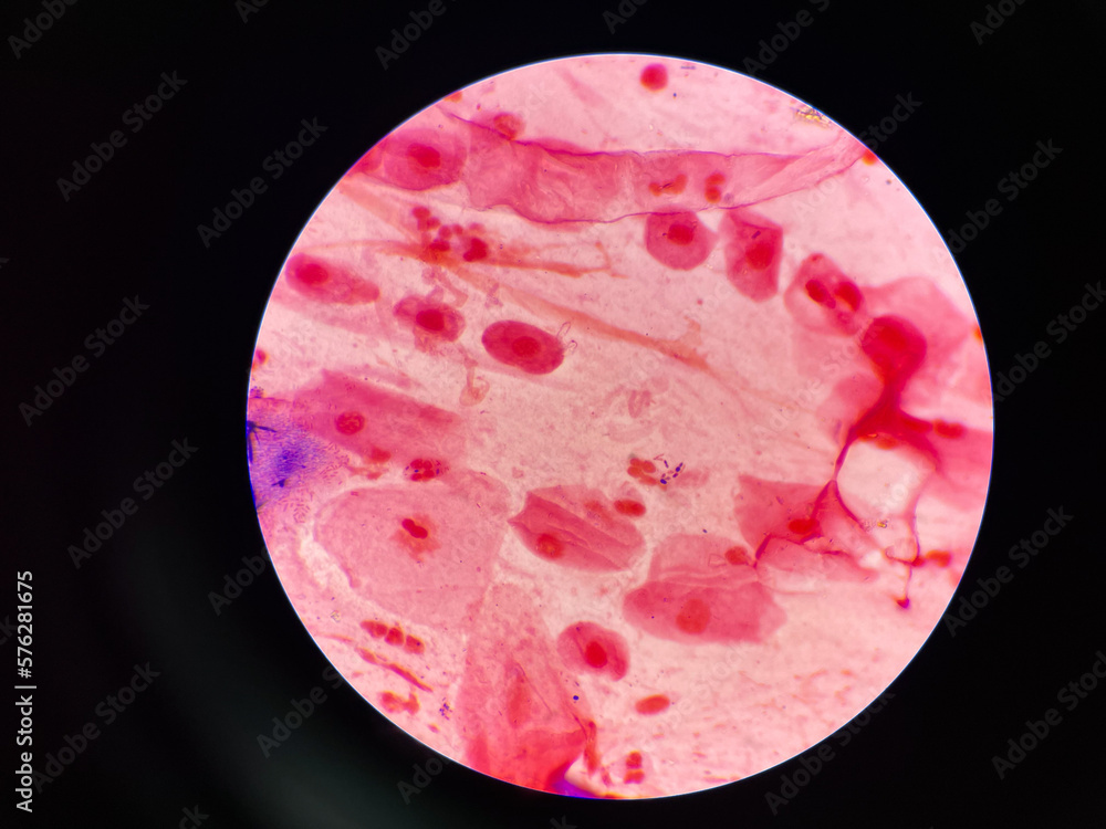 Bacteria cell in sputum sample Gram stain method. Stock Photo | Adobe Stock
