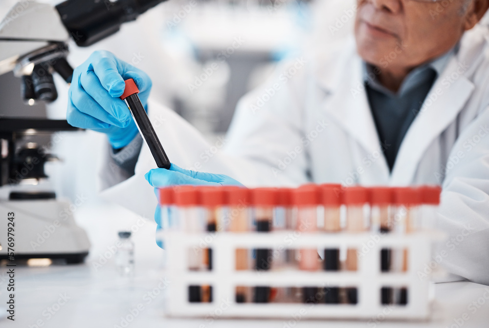 Blood, science and scientist in laboratory with test tube sample for ...