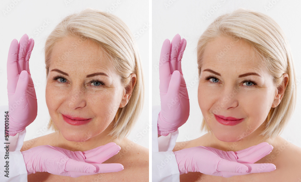 Closeup before after Beauty middle age woman face portrait. Before ...