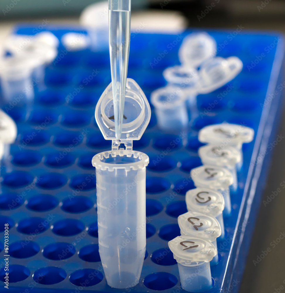 Eppendorf tubes on the rack and pipette. Close up in blue tone Stock ...
