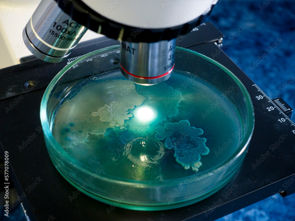 Green bacteria under microscope magnification, Petri dish with ...