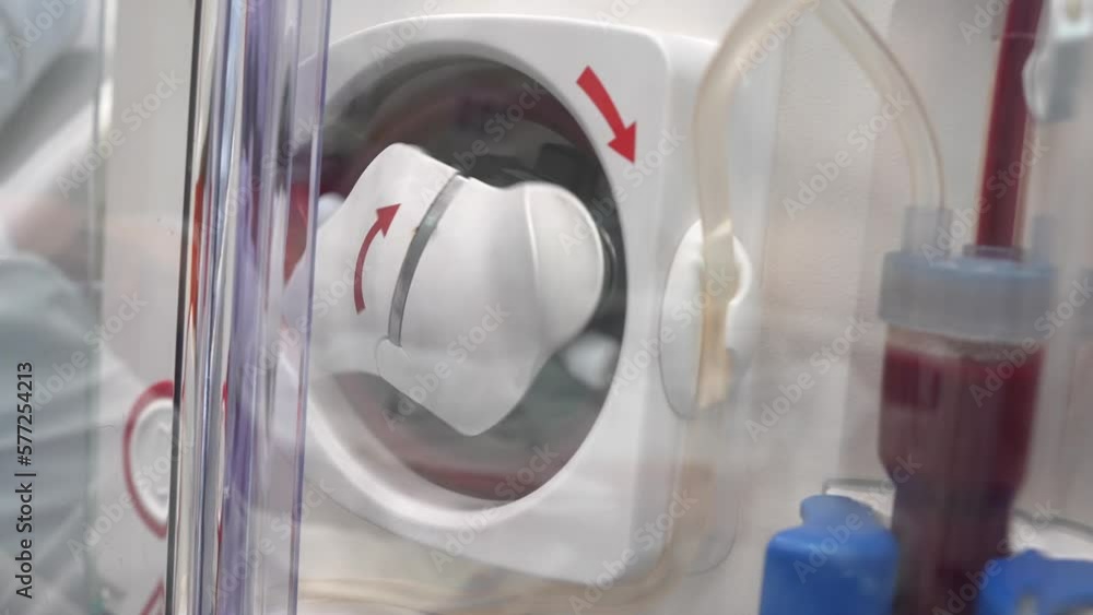 Apheresis machine to extract plasma and platelets from blood. Blood ...