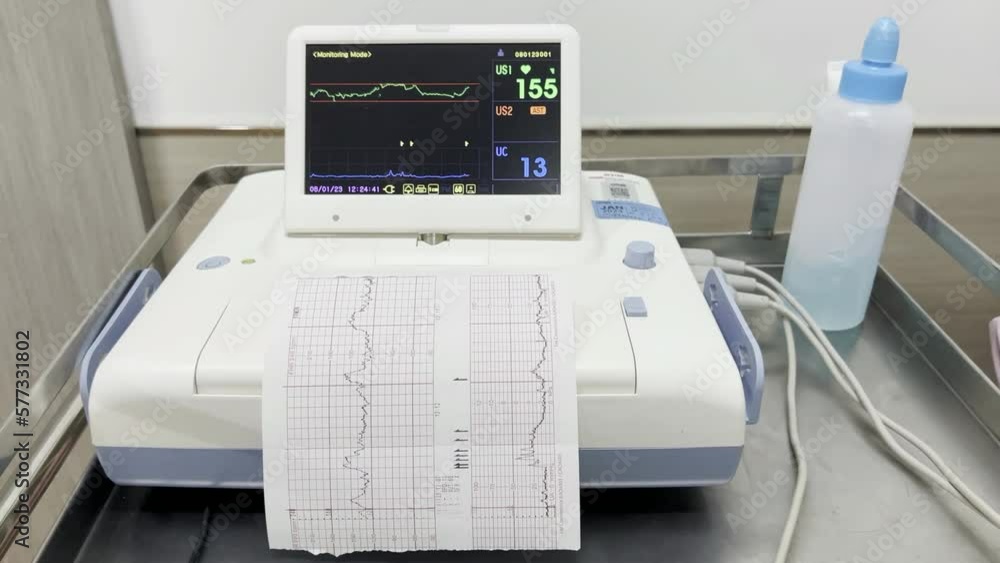 EKG monitor Cardiograph. Cardiograph display during the measurement of ...