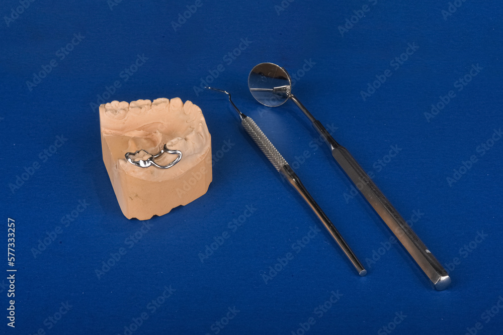 Fotka „Maintain Space for Permanent Teeth with Space Maintainers ...
