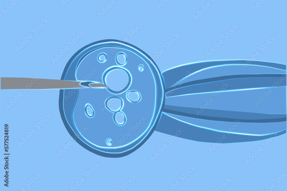 Vector isolated illustration of artificial insemination under a ...