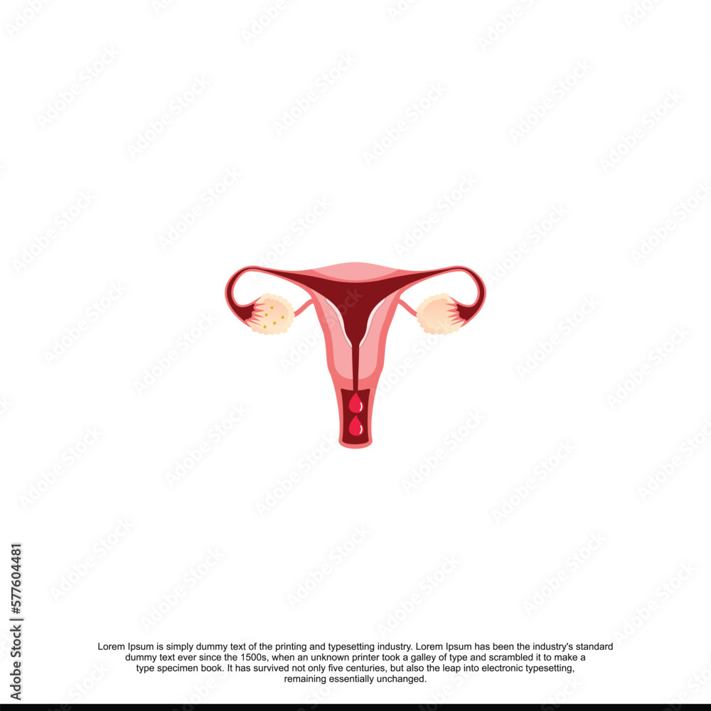 Abnormal Uterine Bleeding Concept, Extremely heavy period. Stock Vector ...
