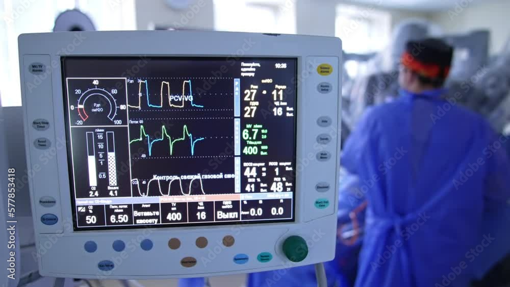 Vidéo Stock Monitor of the lung ventilating machine. Patient’s life ...