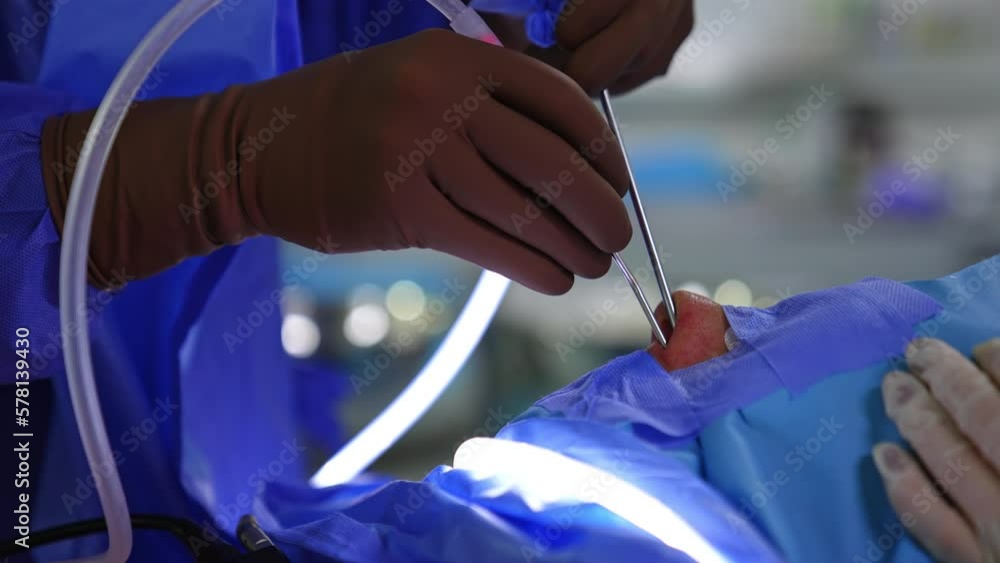 Instruments are input into nasal cavity by gloved hands of surgeon ...