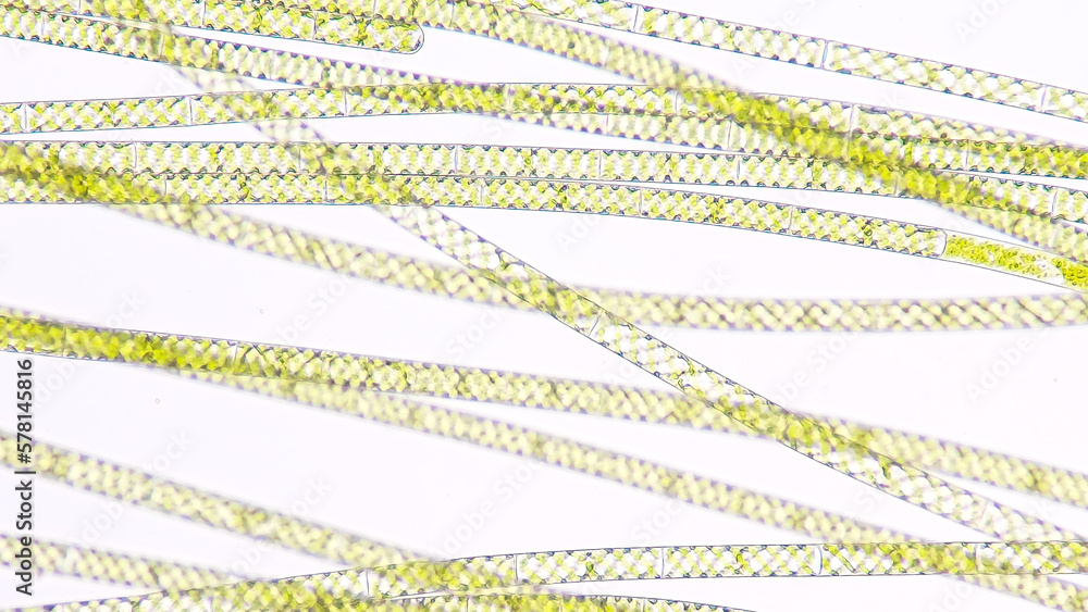 Spirogyra, a filamentous freshwater green algae with spiral arrangement ...
