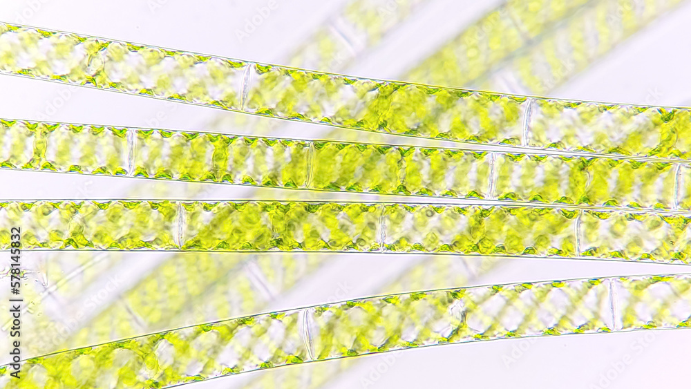 Spirogyra, a filamentous freshwater green algae with spiral arrangement ...
