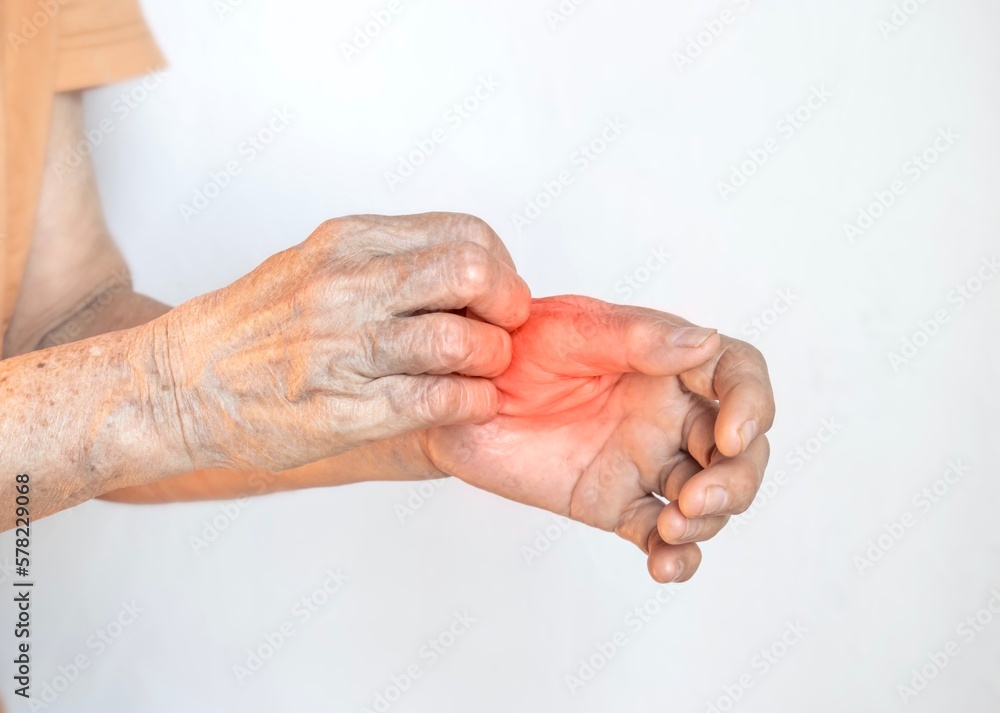 Asian woman scratching her hand. Concept of itchy skin diseases such as ...