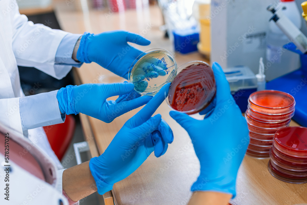 Scientist's hand hold a Petri dish with bacteria. Focused science ...