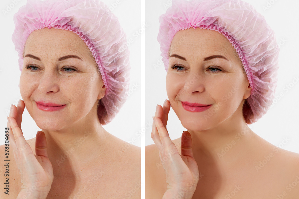 Closeup before after Beauty middle age woman face portrait. Before ...