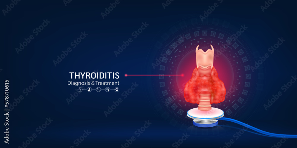 Thyroiditis disease, Human thyroid gland model float away from ...