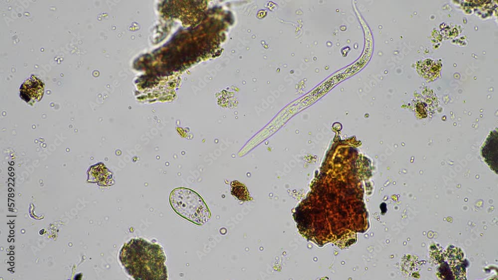soil nematodes, fungi and microorganisms in a soil and compost sample ...