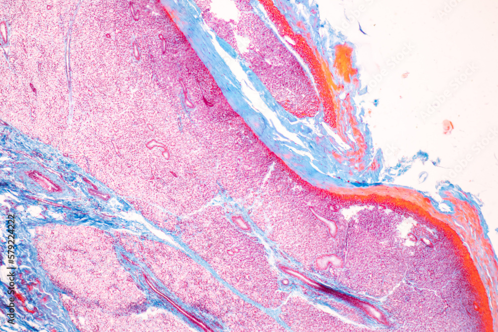 Anatomy and Histological Tonsil and Parotid Human cells under ...