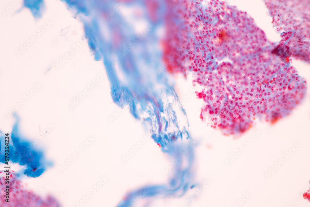 Anatomy and Histological Tonsil and Parotid Human cells under ...