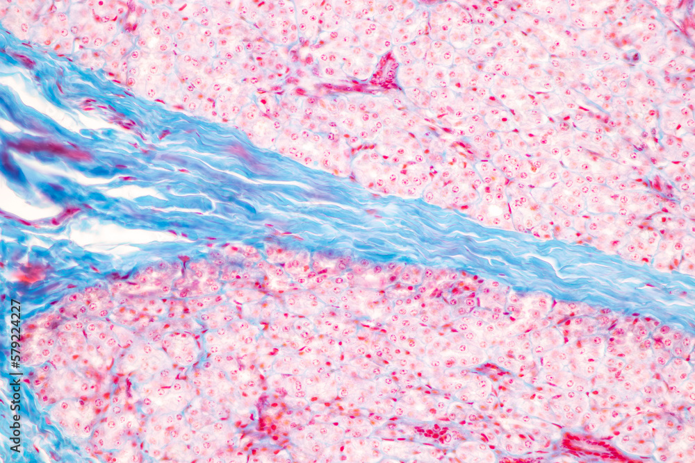 Anatomy and Histological Tonsil and Parotid Human cells under ...