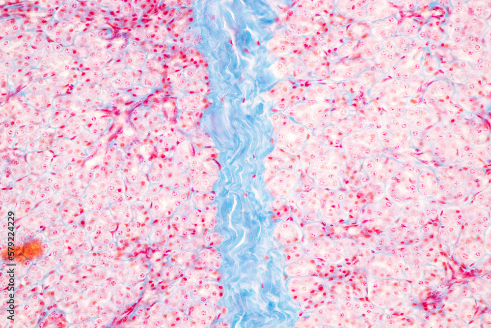 Foto de Anatomy and Histological Tonsil and Parotid Human cells under ...