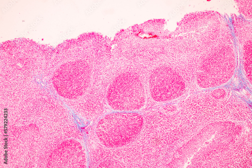 Anatomy and Histological Tonsil and Parotid Human cells under ...