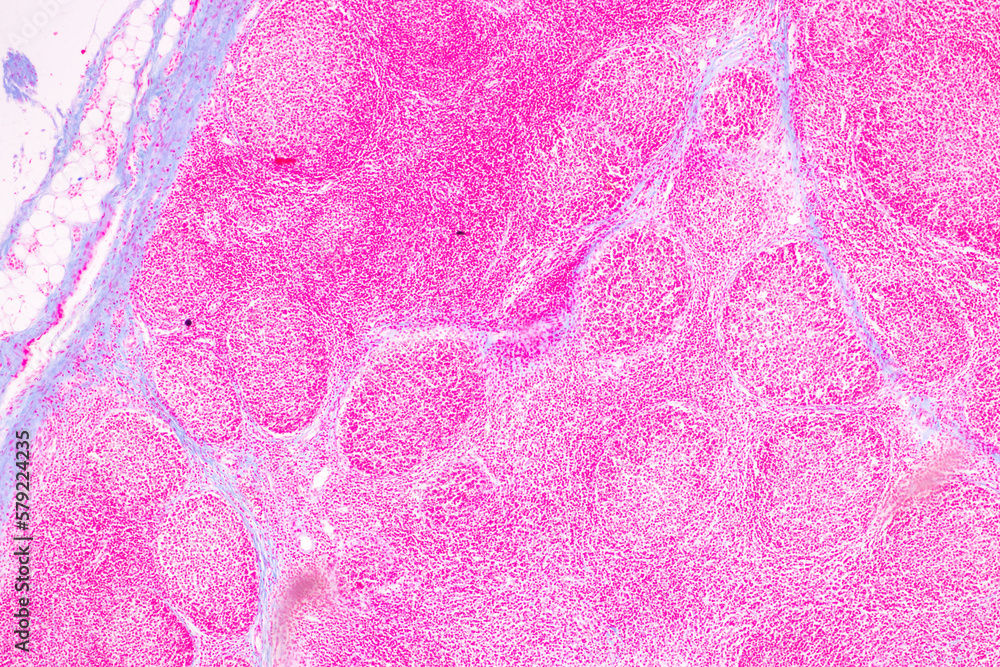 Anatomy and Histological Tonsil and Parotid Human cells under ...