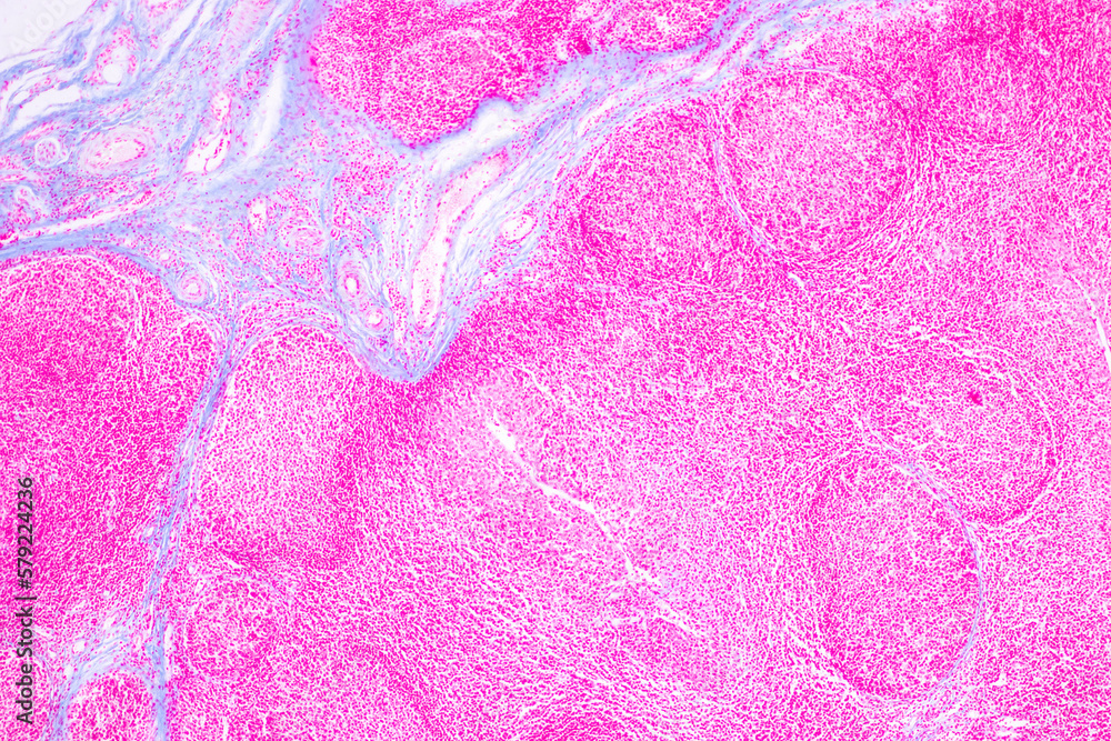 Anatomy and Histological Tonsil and Parotid Human cells under ...