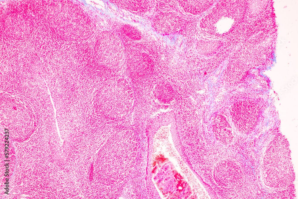 Anatomy and Histological Tonsil and Parotid Human cells under ...