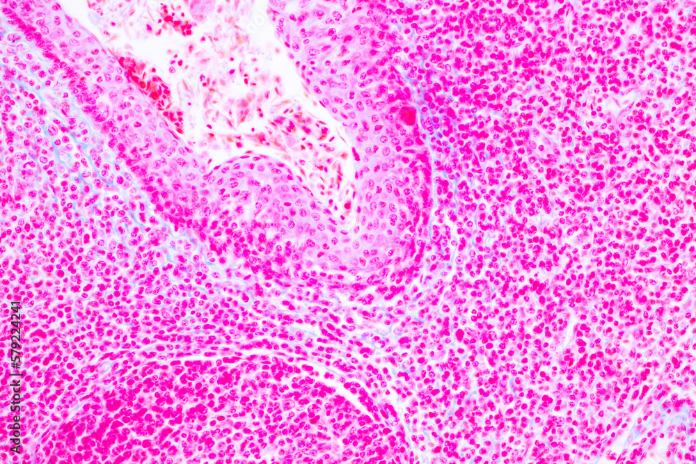 Anatomy and Histological Tonsil and Parotid Human cells under ...