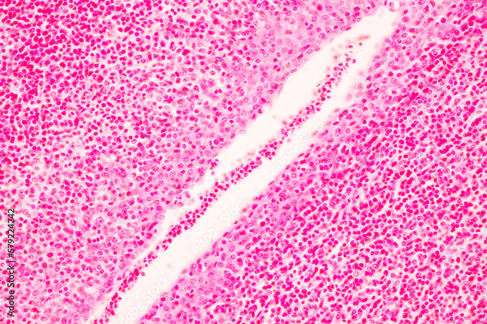 Anatomy and Histological Tonsil and Parotid Human cells under ...