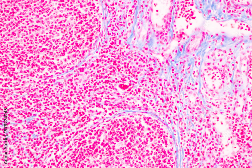 Anatomy and Histological Tonsil and Parotid Human cells under ...