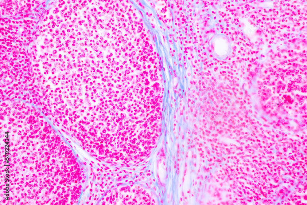 Anatomy and Histological Tonsil and Parotid Human cells under ...