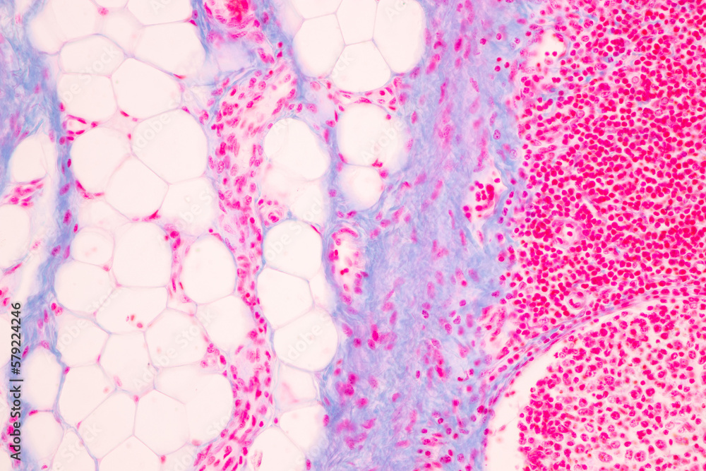 Anatomy and Histological Tonsil and Parotid Human cells under ...