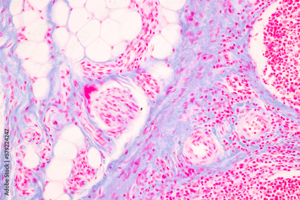 Anatomy and Histological Tonsil and Parotid Human cells under ...