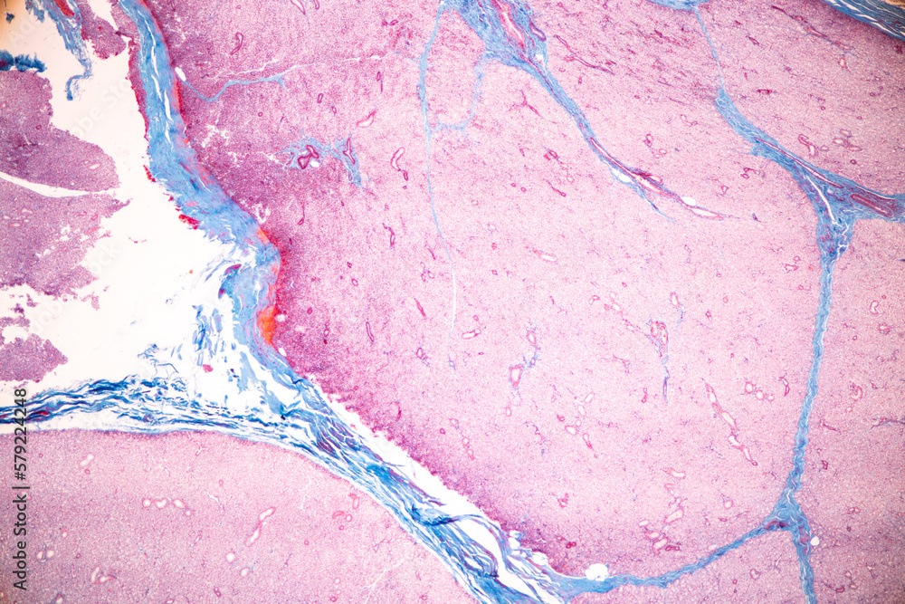 Anatomy and Histological Tonsil and Parotid Human cells under ...