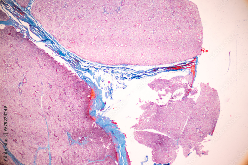 Anatomy and Histological Tonsil and Parotid Human cells under ...