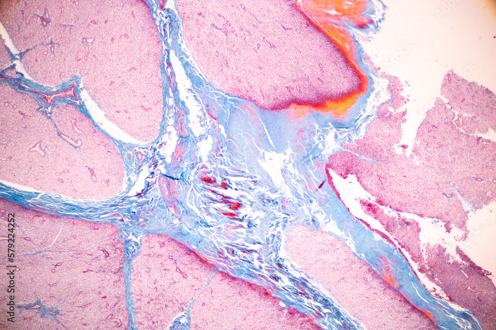 Anatomy and Histological Tonsil and Parotid Human cells under ...