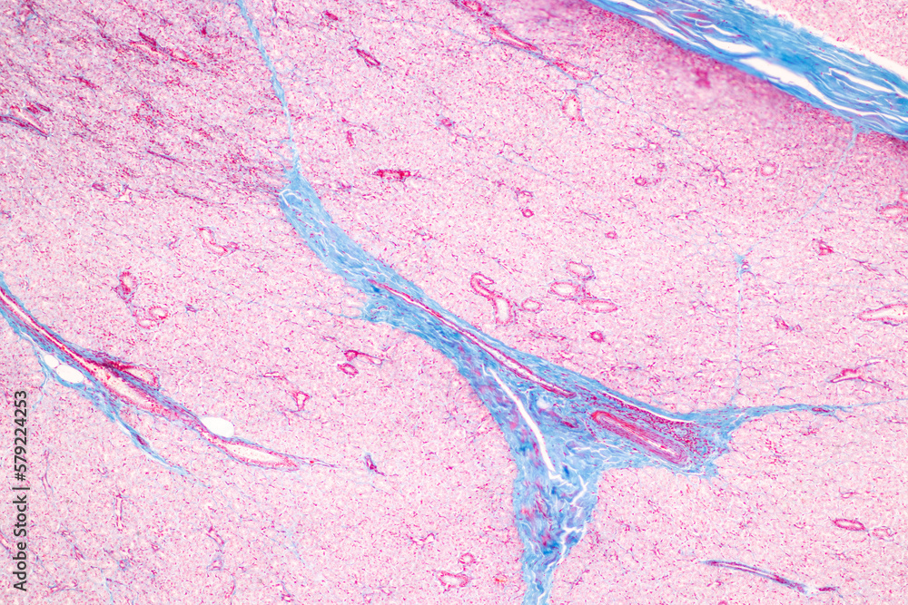 Anatomy and Histological Tonsil and Parotid Human cells under ...